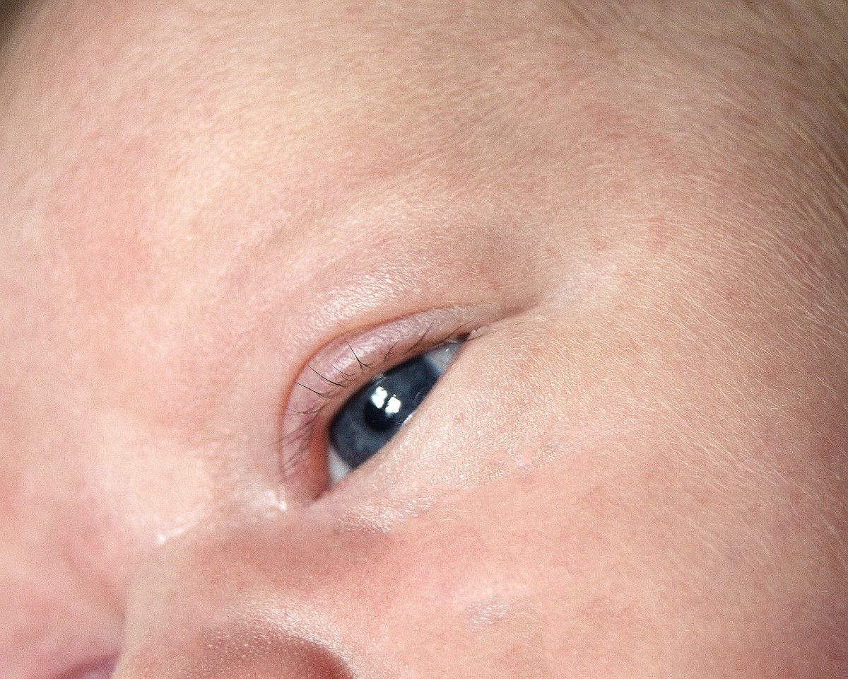 Żółtaczka fizjologiczna – co musisz o niej wiedzieć?